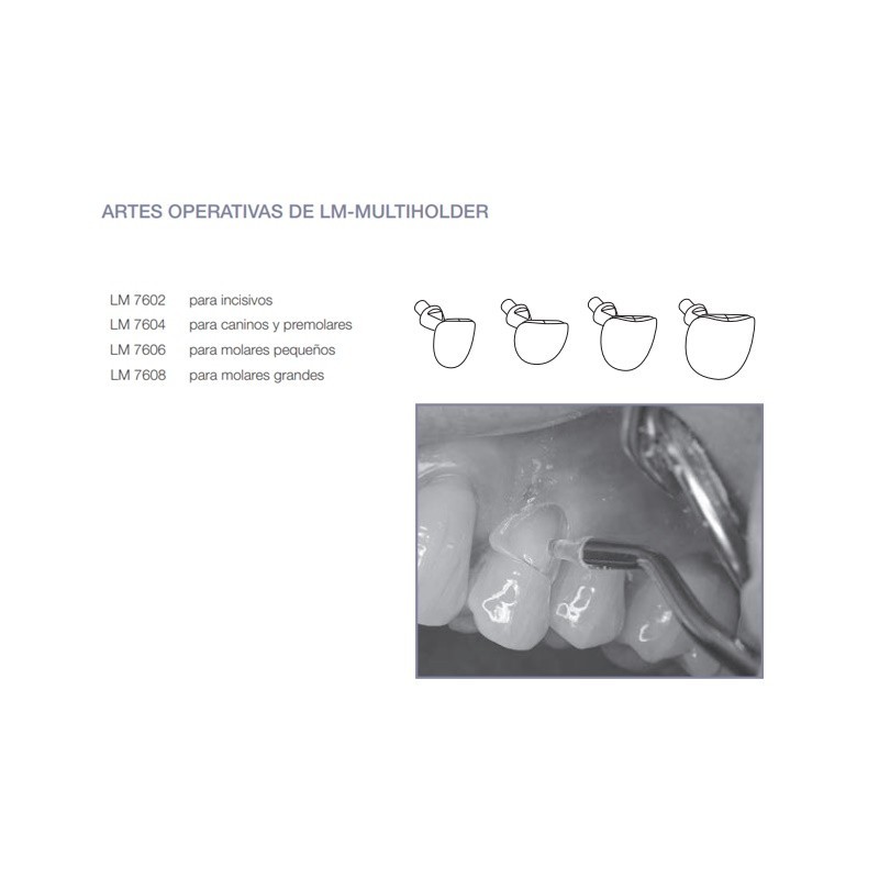 MATRICES CERVICALES LM 60u. TIPO PARA CANINOS Y PREMOLARES