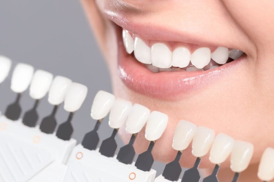 Resinas dentales, el éxito de tus restauraciones